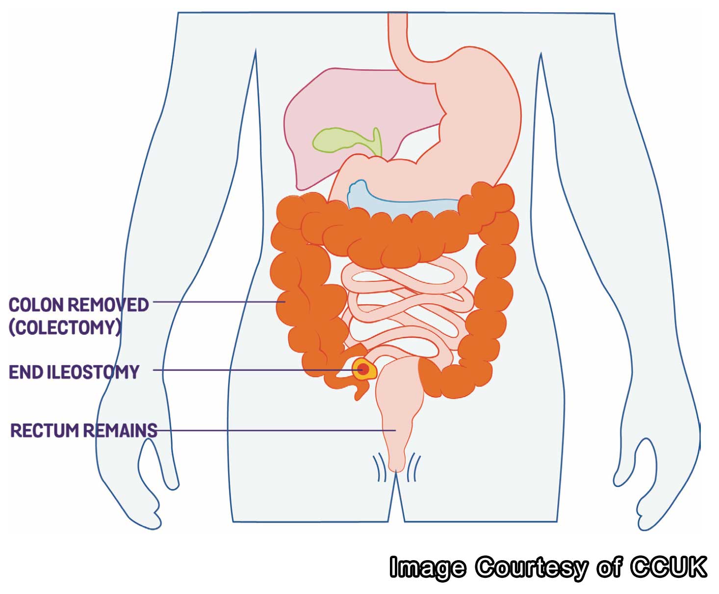 Services - The Colchester IBD centre